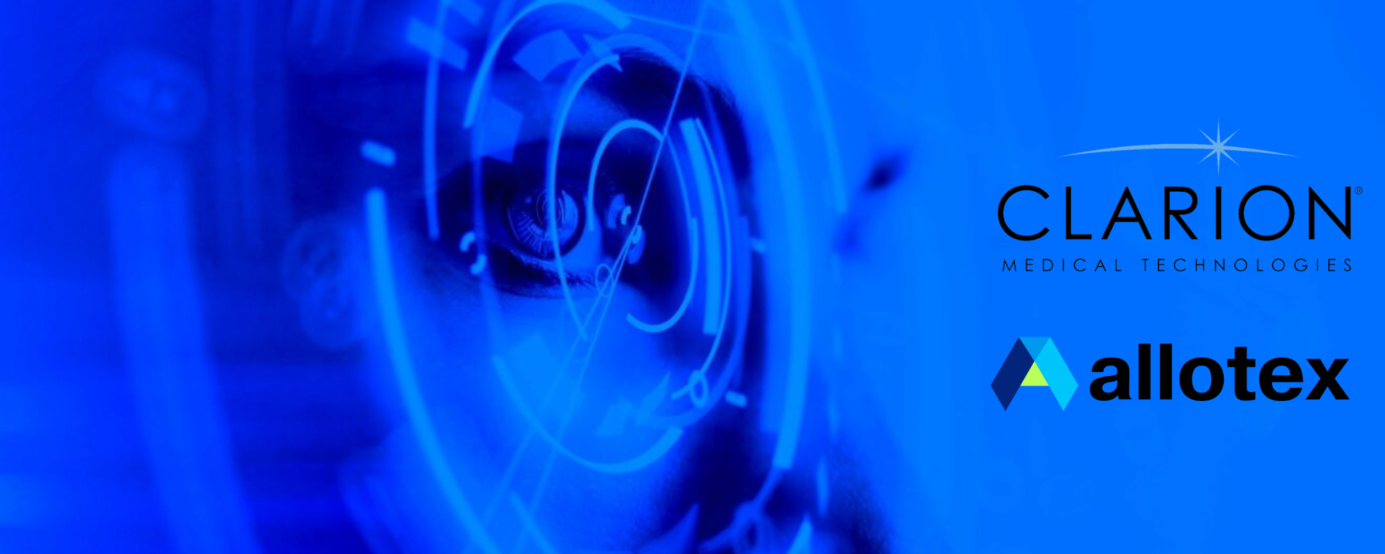 A New Step Forward in Biologic Vision Enhancement - TransForm™ now ...